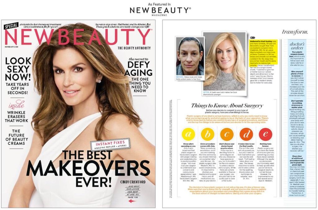 PROJECT GLAMMERS Before & After photos featured in NewBeauty Magazine ...